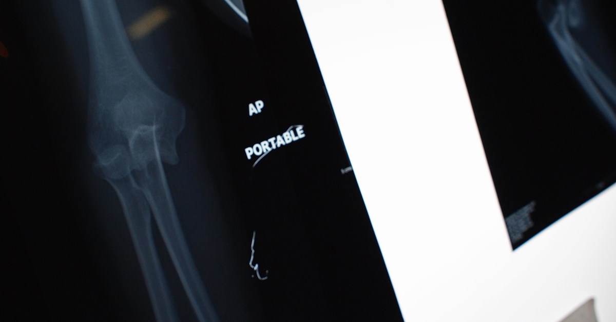 Recovering Damaged X-Rays - Polygon Group